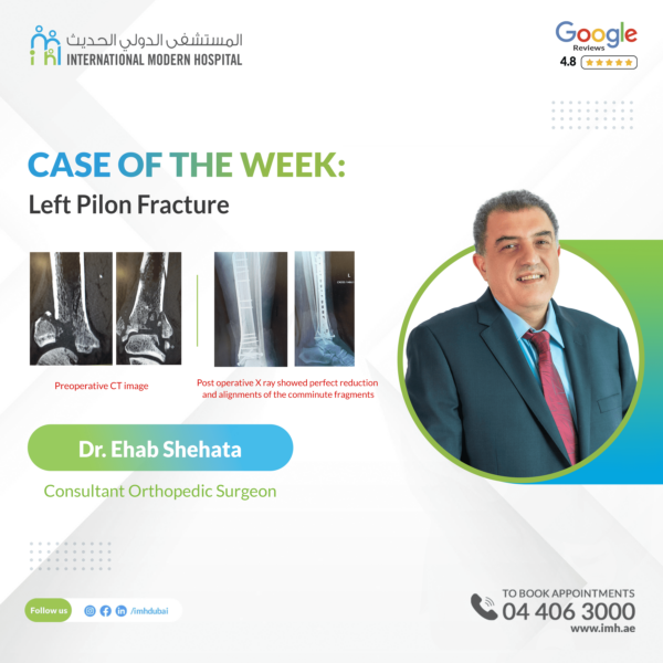 IMH Case Of the Week – Left Pilon Fracture | Dr. Ehab Shehata